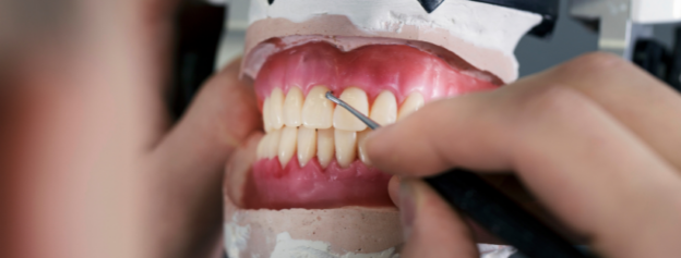 Understanding Dental Occlusion: Anatomy, Function, and Related Problems ...