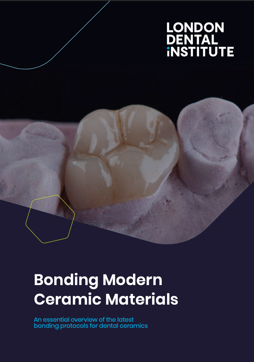 Bonding Modern Ceramic Materials | London Dental Institute