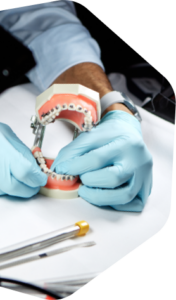 Effectiveness of Removable Anterior Bite Planes with Varied Mealtime ...