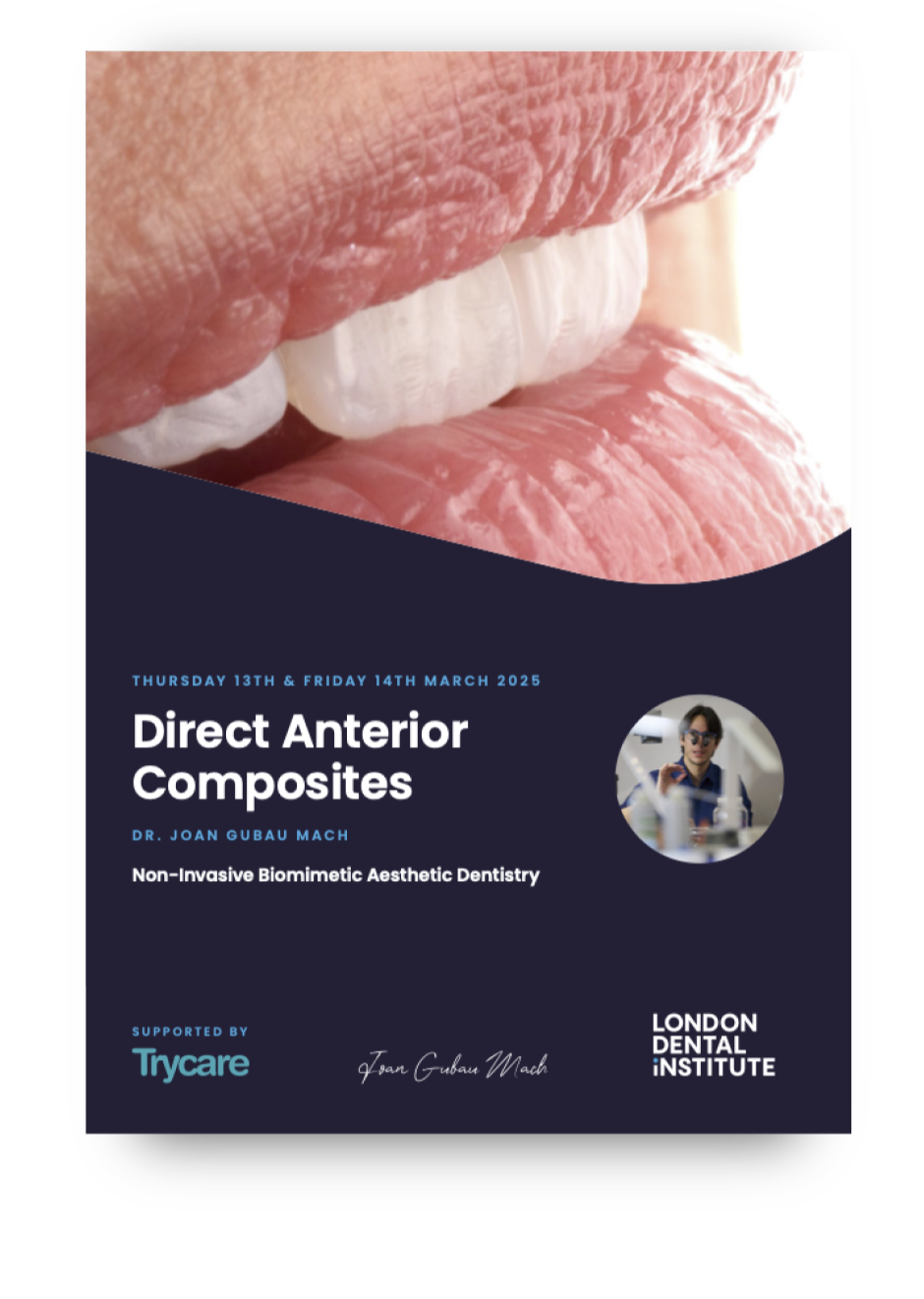 Composite Bonding Courses | London Dental Institute